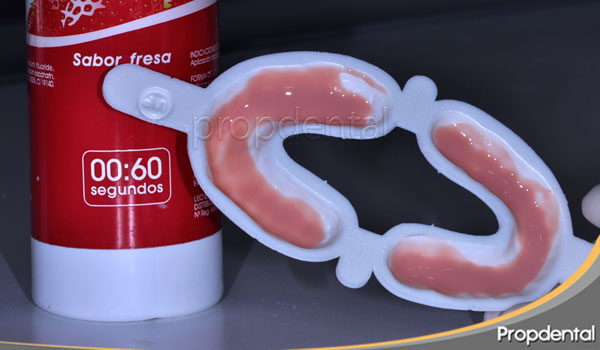 ¿Que es el Fluor dental? Beneficios del flúor dental sobre los dientes ¿Que es el Fluor dental? Beneficios del flúor dental sobre los dientes
